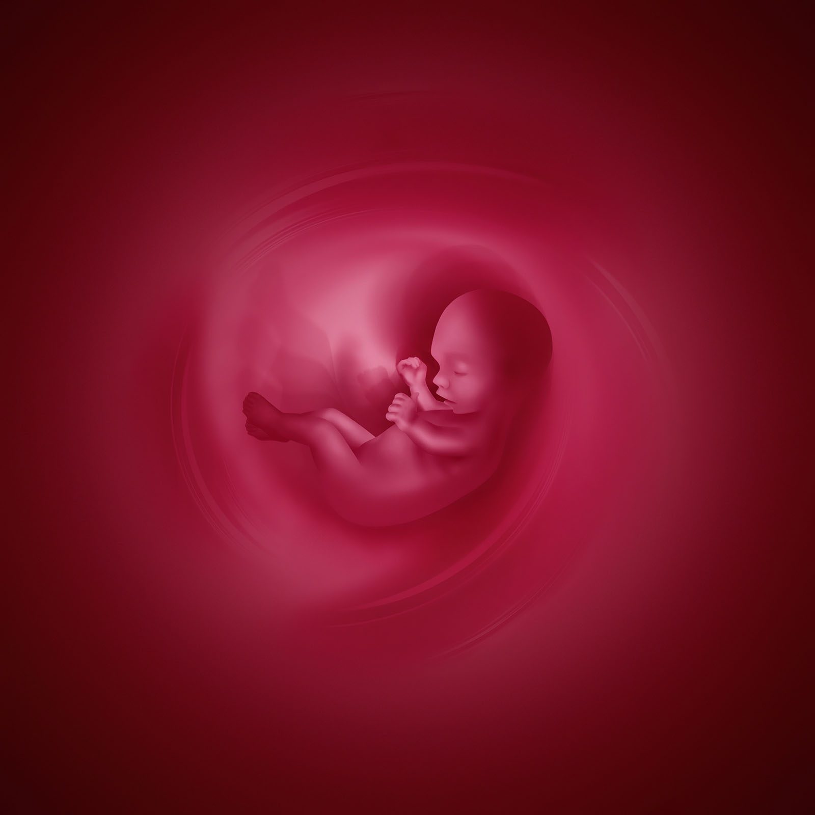 Our Placentas II - Placenta accrete - Shared Conception